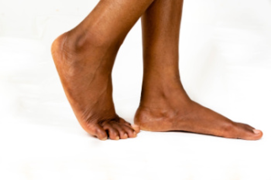 Identification and Diagnosis of Flat Feet